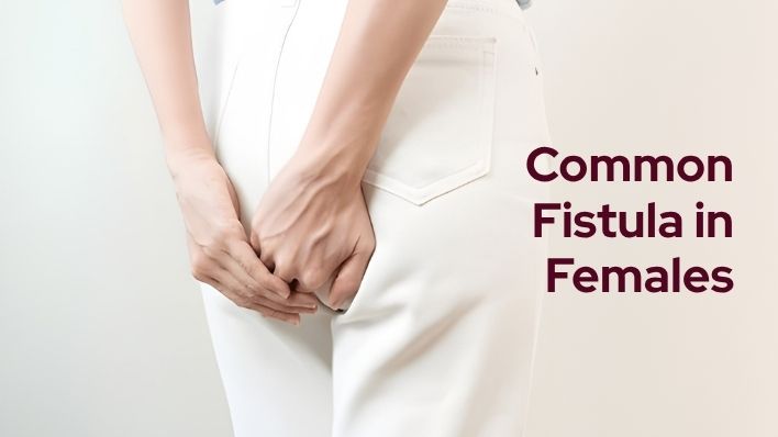 Most Common Fistula in Females | Dr. Jay Mehta